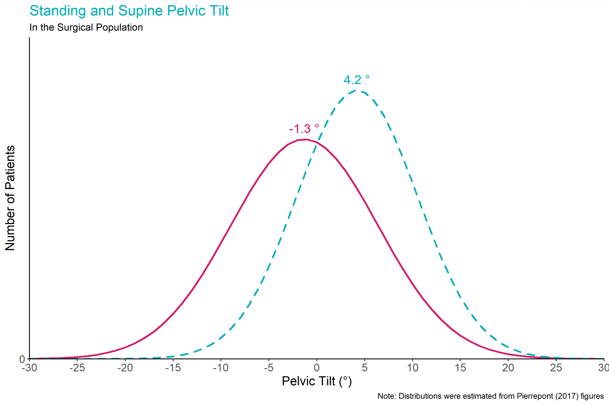 Accommodating Pelvic Tilt When Using Navigation – Navbit