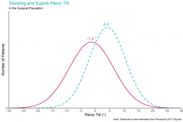 Accommodating Pelvic Tilt When Using Navigation – Navbit