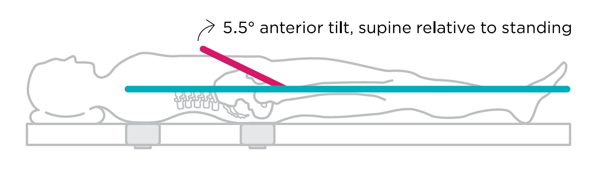 Accommodating Pelvic Tilt When Using Navigation – Navbit